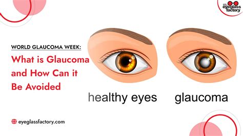 World Glaucoma Week Raising Awareness For Healthier Vision