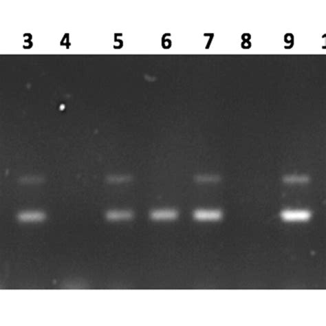 Multiplex Pcr Consist Of Il 10 Rs1800896 Primer G Vs Primer A Genotype