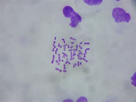 Human Chromosomes Under The Microscope Stock Image Image Of Human Calligraphy 381986309