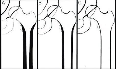 Dossick And Dorr Classification Download Scientific Diagram