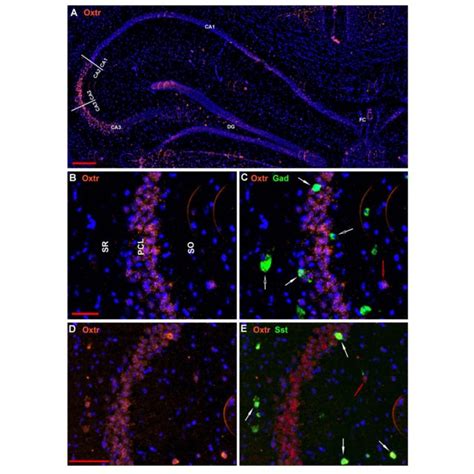 Schematic Representation Of A Coronal Section Of The Rat Brain Showing Download Scientific