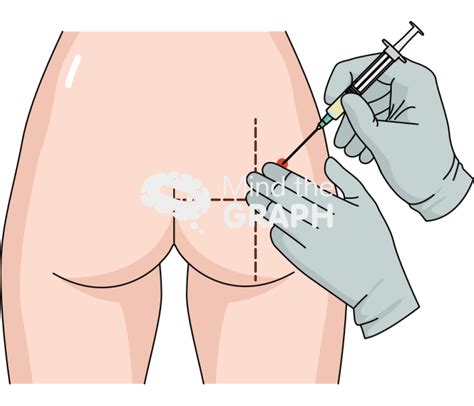 Ventrogluteal Ventrogluteal Injection Pad Female Adult Light