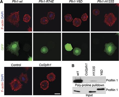 Profilin 1 Requires Actin And Poly Proline Binding In Chondrocytes A Download Scientific