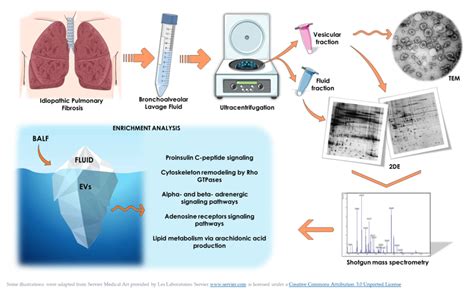 Proteome Characterization Of Balf Extracellular Vesicles In Idiopathic