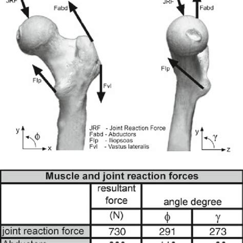 pdf topological optimization in hip prosthesis design