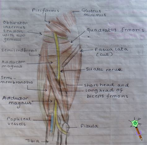 Medicowesome Sciatic Nerve Distribution And Sciatica