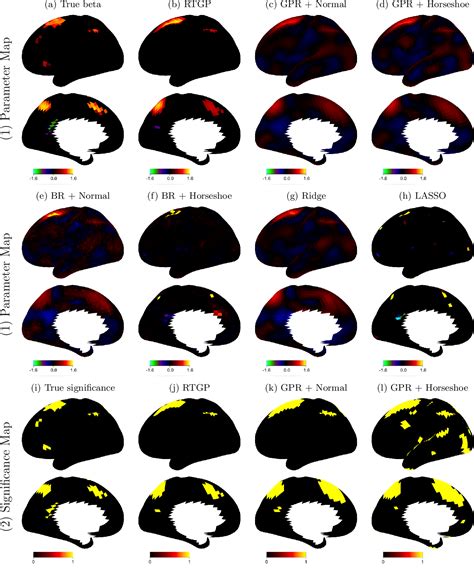 Figure 2 From Scalable Scalar On Image Cortical Surface Regression With A Relaxed Thresholded