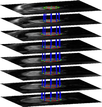 Continuous Representation Of The Surface Model Using A Polynomial Download Scientific Diagram