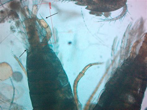 Can You Help Me Identifying This Calanoid Copepod Researchgate