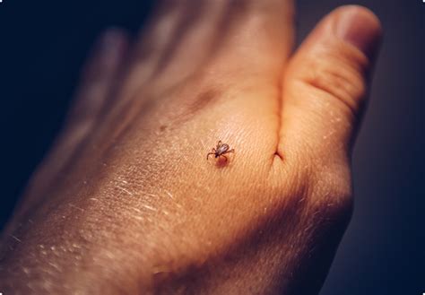 Immunoserology Of Lyme Panel A Rn Labs