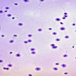 Micrograph From A Bright Microscope Field Through A X Optical Lens Download Scientific