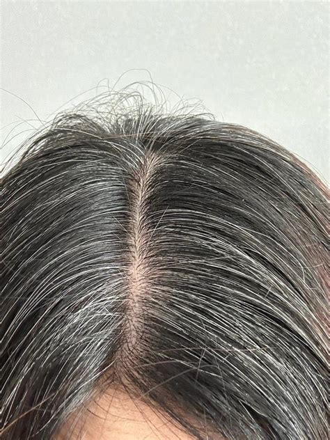 白发日益增多，原来是缺这几种元素！ 知乎