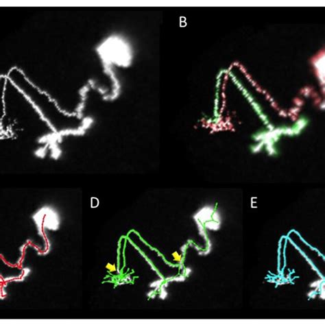 An Example Of Segmentation Of A Neuron With Several Arborizations