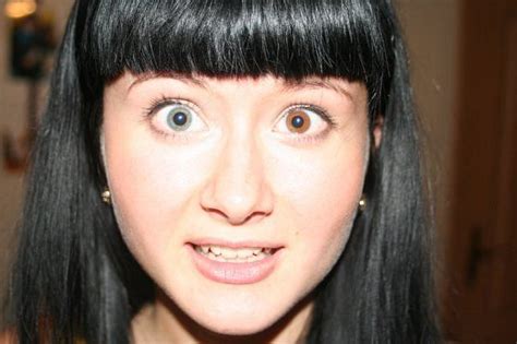 Laugh Gags Heterochromia In Humans Different Color Eyes Heterochromia Different Colored