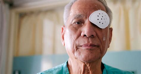 Understanding The Restrictions After Cataract Surgery