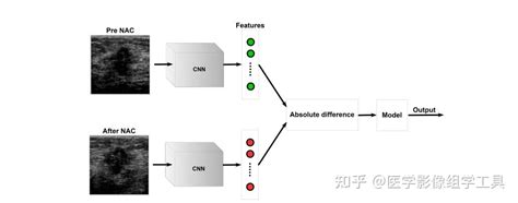 （中科院二区）周日上午九点训练营直播讲解：利用暹罗卷积神经网络预测乳腺癌超声对新辅助化疗的早期反应 知乎