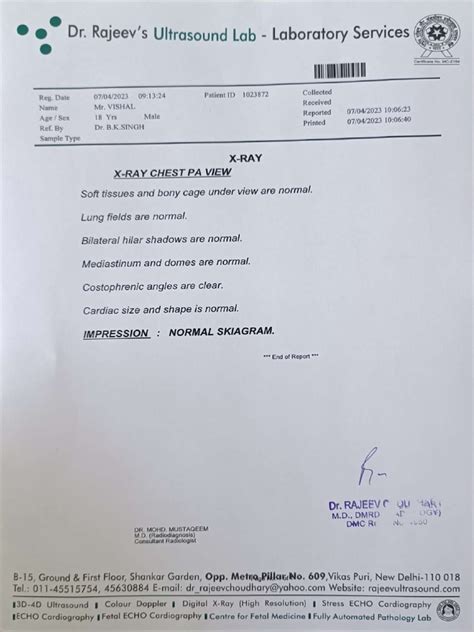 x ray chest pa view report pdf