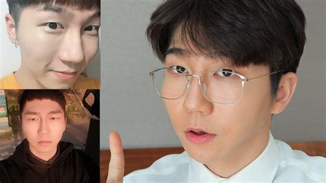 내가 코필러 2번 맞고 더 이상 안 맞는 이유 코 퍼짐과 부작용 보여드립니다 Youtube