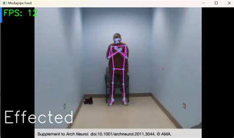 GitHub MayukhaMandya Cerebral Disease Detection