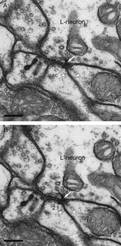 Neuron Electron Microscope