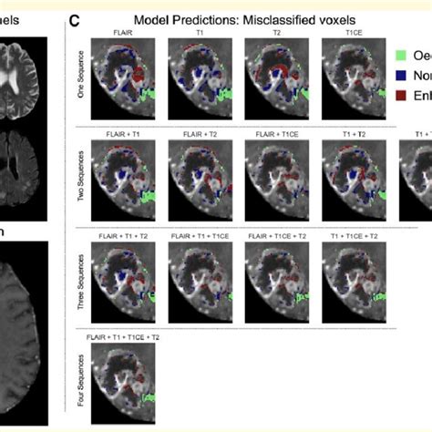 Minimal Error In Example Segmentation Results A Left Upper Panel Download Scientific Diagram