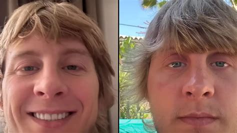 Paddy The Baddy Takes Two Selfies After Fight To See How Much Weight He Puts On In Just One Week