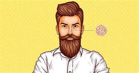 Ways To Remove Blackheads From Face