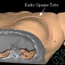 Color The CT Isocenter Is Placed At The Intersection Of The Download Scientific Diagram