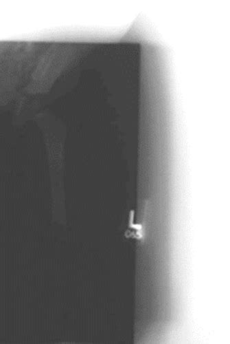 Image Processing And Manipulation Flashcards Quizlet