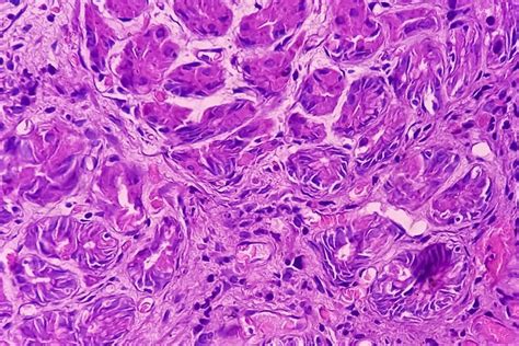 Errγ Controls Parietal Cells Generation And Maturation From Stem Cells