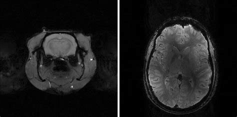Single Slice Gradient Echo Images Acquired With The Vendor Supplied