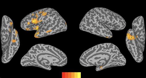 Correspondence Between The Phonological Output Similarity Structure And