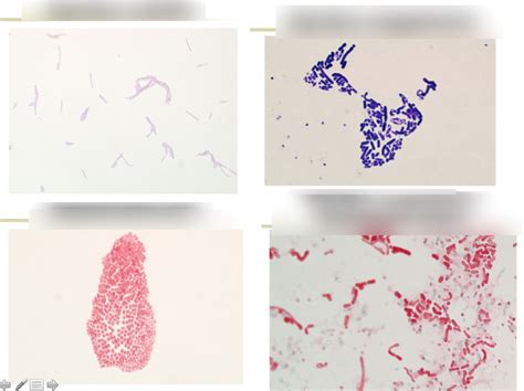 Micro Lab Midterm Diagram Quizlet