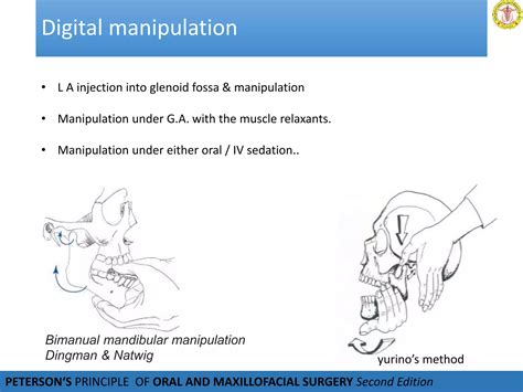 Temporomandibular Joint Dislocation Pptx