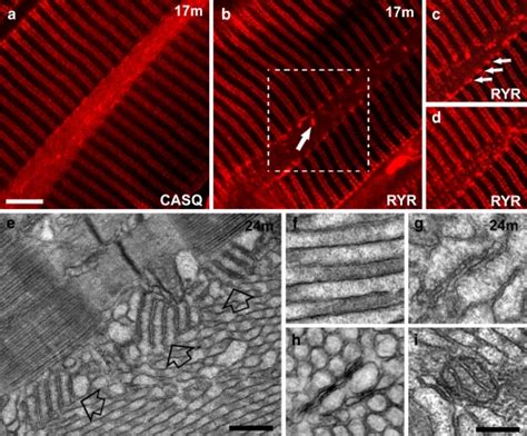 Sequential Stages In The Age Dependent Gradual Formation And