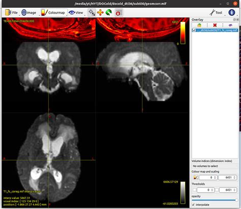 Error When Coregister The T1w To The Diffusion Image Preprocessing