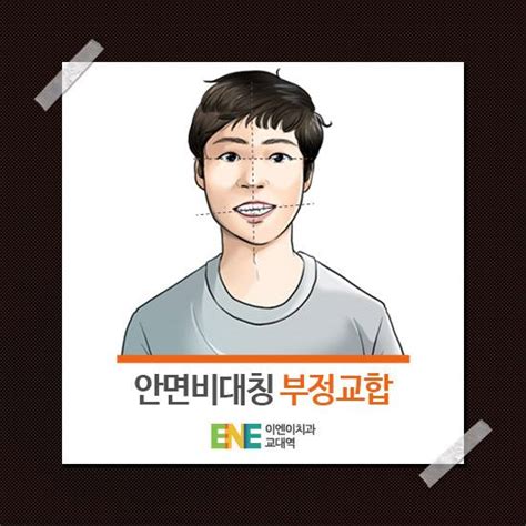 이엔이치과 교대역 안면비대칭도 포인트양악수술로 해결 누구나 조금의 안면비대칭 증상은 가지고