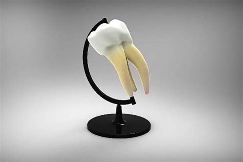 Extra Teeth Removal Surgery Extraction Hyperdontia