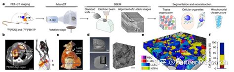 Nature 肺癌线粒体网络和生物能学的空间定位 知乎