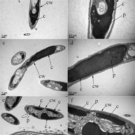 Ultrastructural Observation Of Pyropia Haitanensis Conchocelis