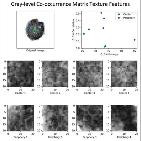 Example Of Glcm Texture Analysis On A Gray Scale Image Of Aβ Stained