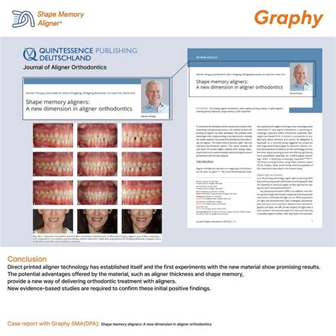 New Article On Shape Memory Aligner Graphy Posted On The Topic Linkedin