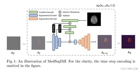 Diffusion Medical Image Segmentationdiffusion Models For Implicit