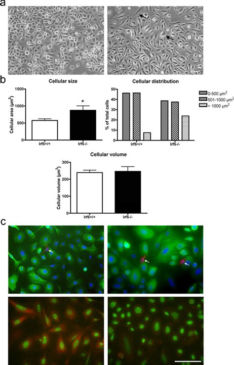 Interferon Regulatory Factor 6 Is Necessary But Not Sufficient For Keratinocyte Differentiation