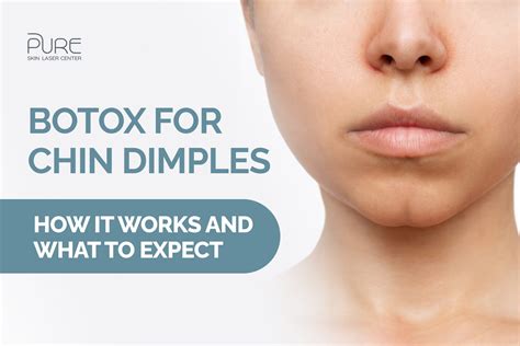 Botox For Chin Dimples How It Works And What To Expect