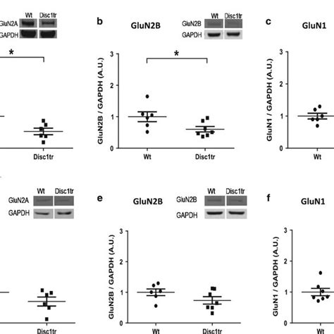 Altered Nmda Receptor Nmdar Subunit Protein Expression In The