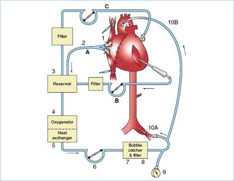 Anesthetic Management During Cardiopulmonary Bypass Anesthesia Key
