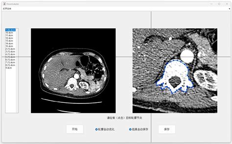 基于matlab的医学影像勾画分割提取系统 gui界面 索炜达 猿创