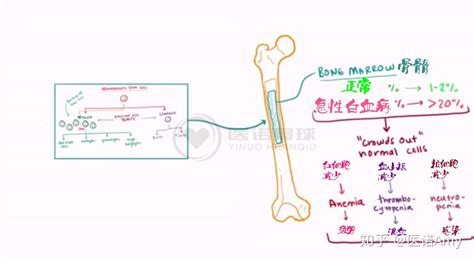 白血病系列之一（白血病机理及分类） 知乎