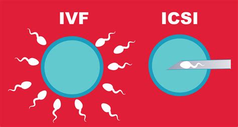 Ivf Vs Icsi Which Is More Successful Inside Ivf